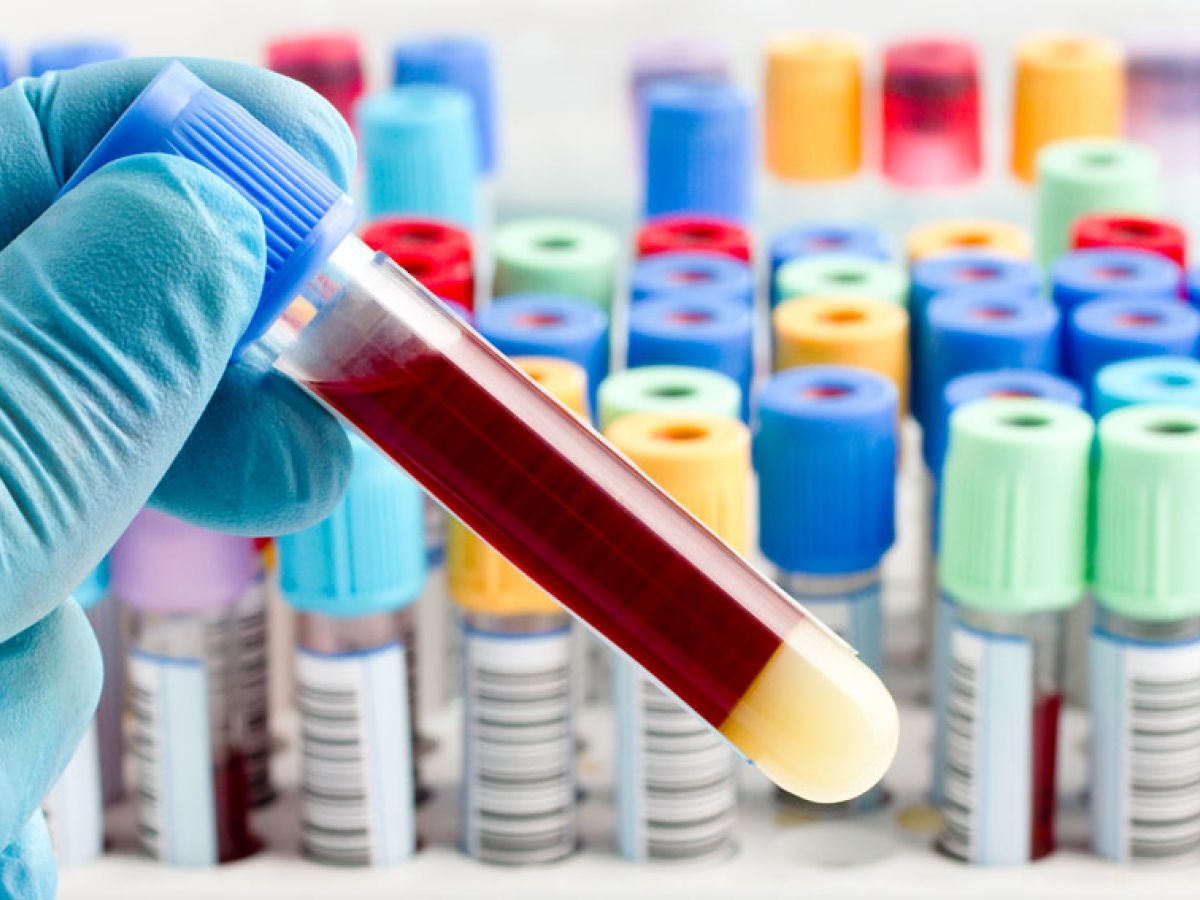 Por Dentro Salud Un Examen De Sangre Sería Clave Para Detectar Ocho
